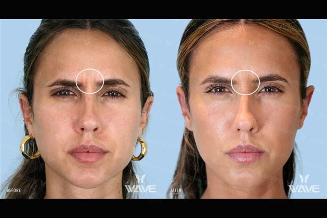 Plastic Surgery Specials | Wave Plastic Surgery